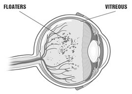 Diabetic Retinopathy Treatment Columbus MS